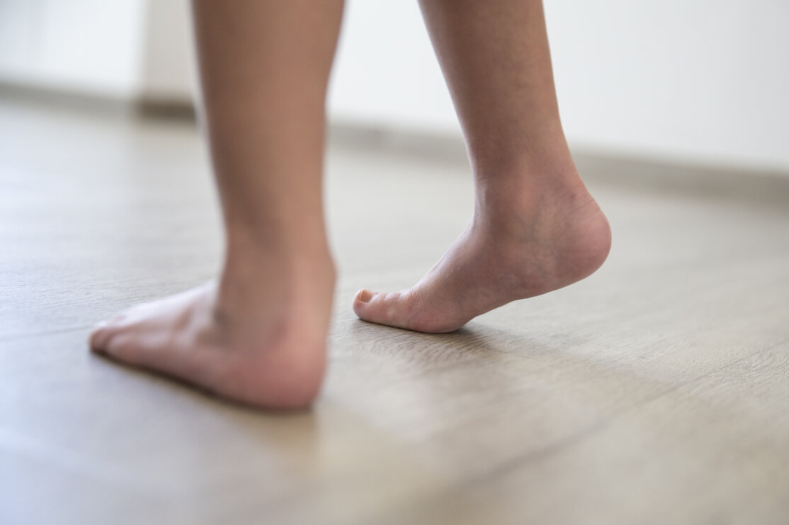 Spitzfuß: Symptome, Ursachen und Behandlung mit Orthesen