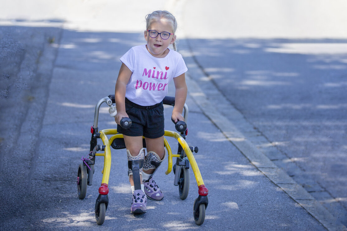 Spina bifida: offener Rücken (Myelomeningocele, MMC) | Pohlig GmbH