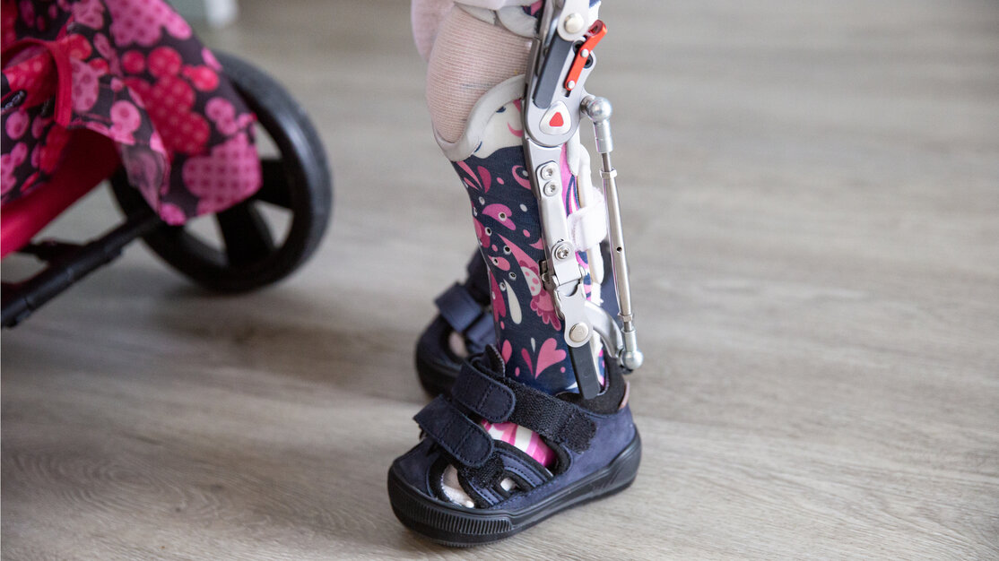 Spina bifida: offener Rücken (Myelomeningocele, MMC) | Pohlig GmbH