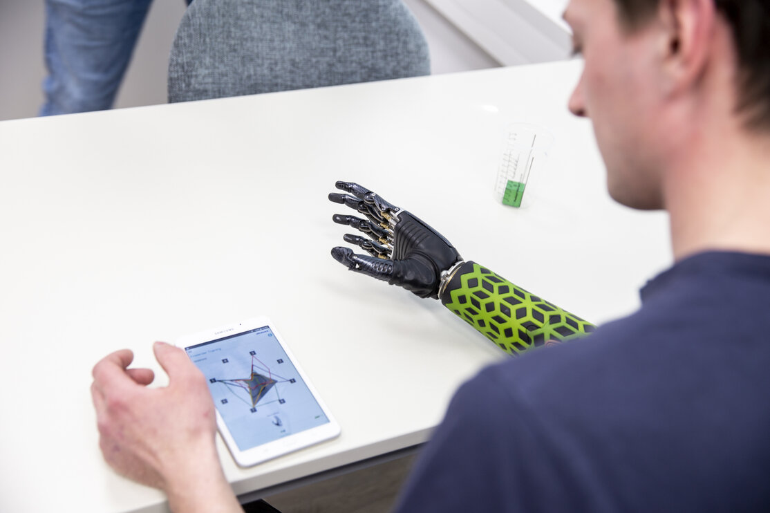 Physiotherapy in arm prosthetics | Pohlig