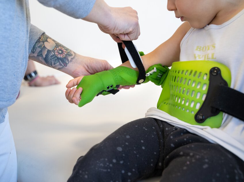 Fingerorthese, Handorthese, Armorthese | Pohlig