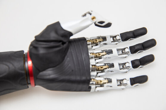 Types of prostheses: cosmetic, myoelectric, self-powered