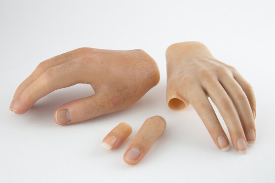 Silicone finger prosthesis | Pohlig