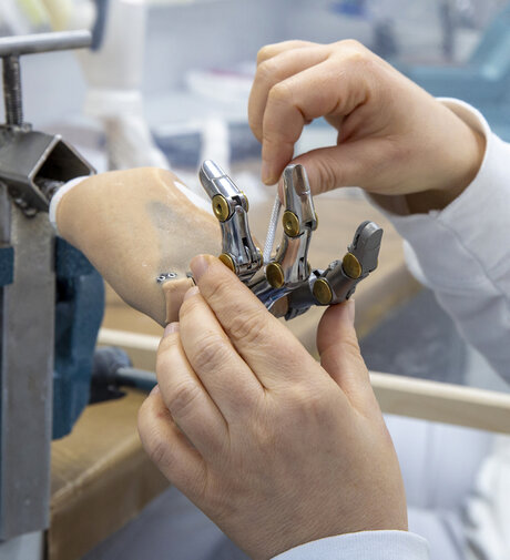 Finger-, Hand- & Armprothesen: Warum Pohlig?
