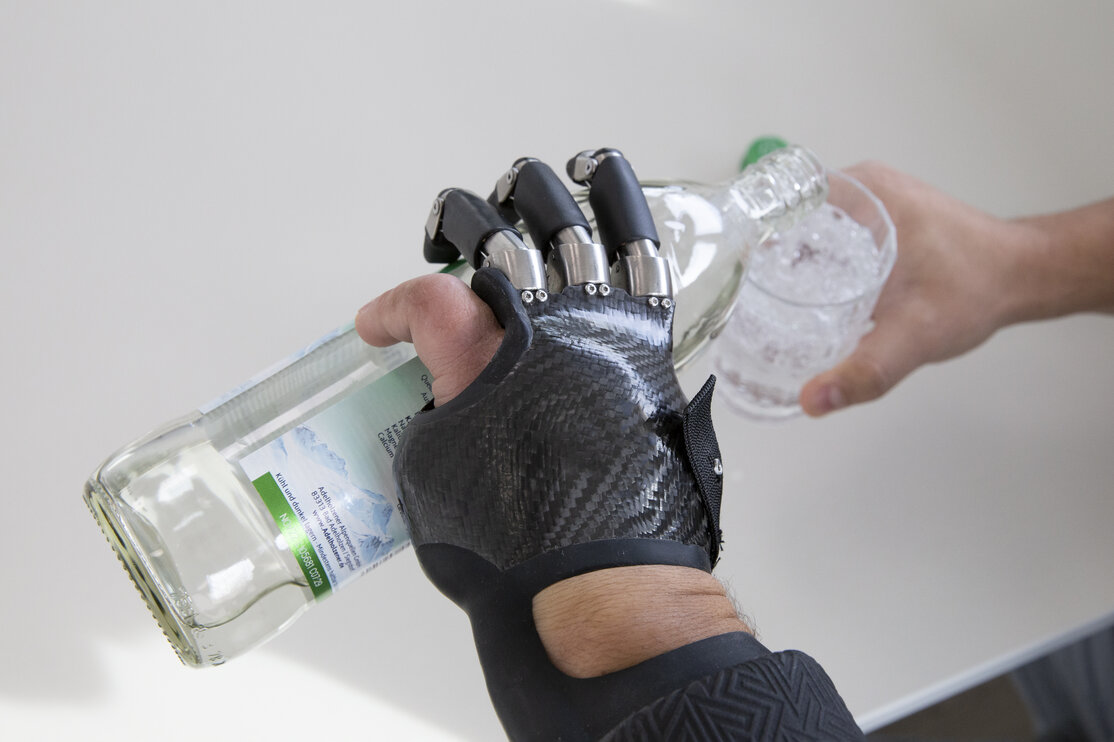 Passive und myoelektrische (Teil-)Handprothese