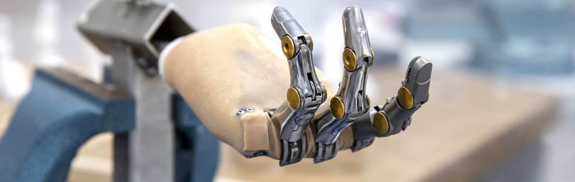 Prostheses for finger, hand, and arm - why Pohlig?