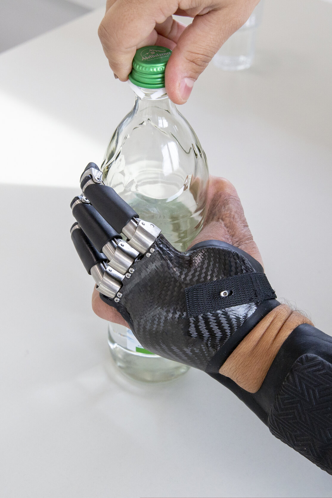 Passive und myoelektrische (Teil-)Handprothese