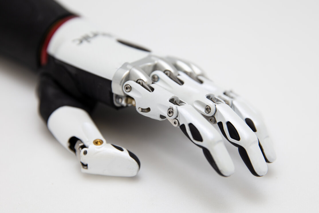 Passive und myoelektrische (Teil-)Handprothese