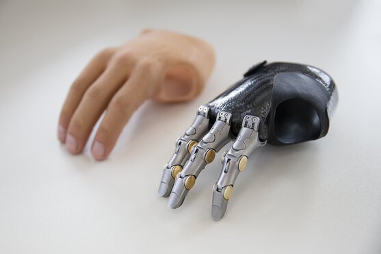 Passive und myoelektrische (Teil-)Handprothese