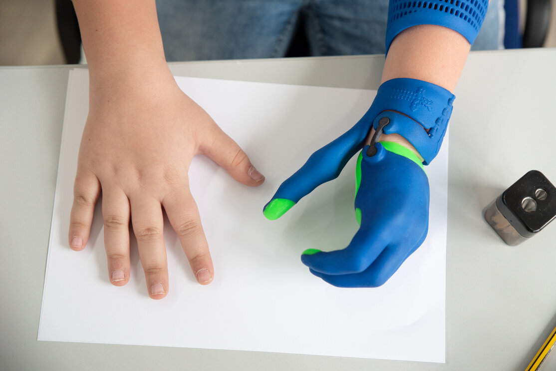 Prothesentypen: Habitus, myoelektrisch, Eigenkraft