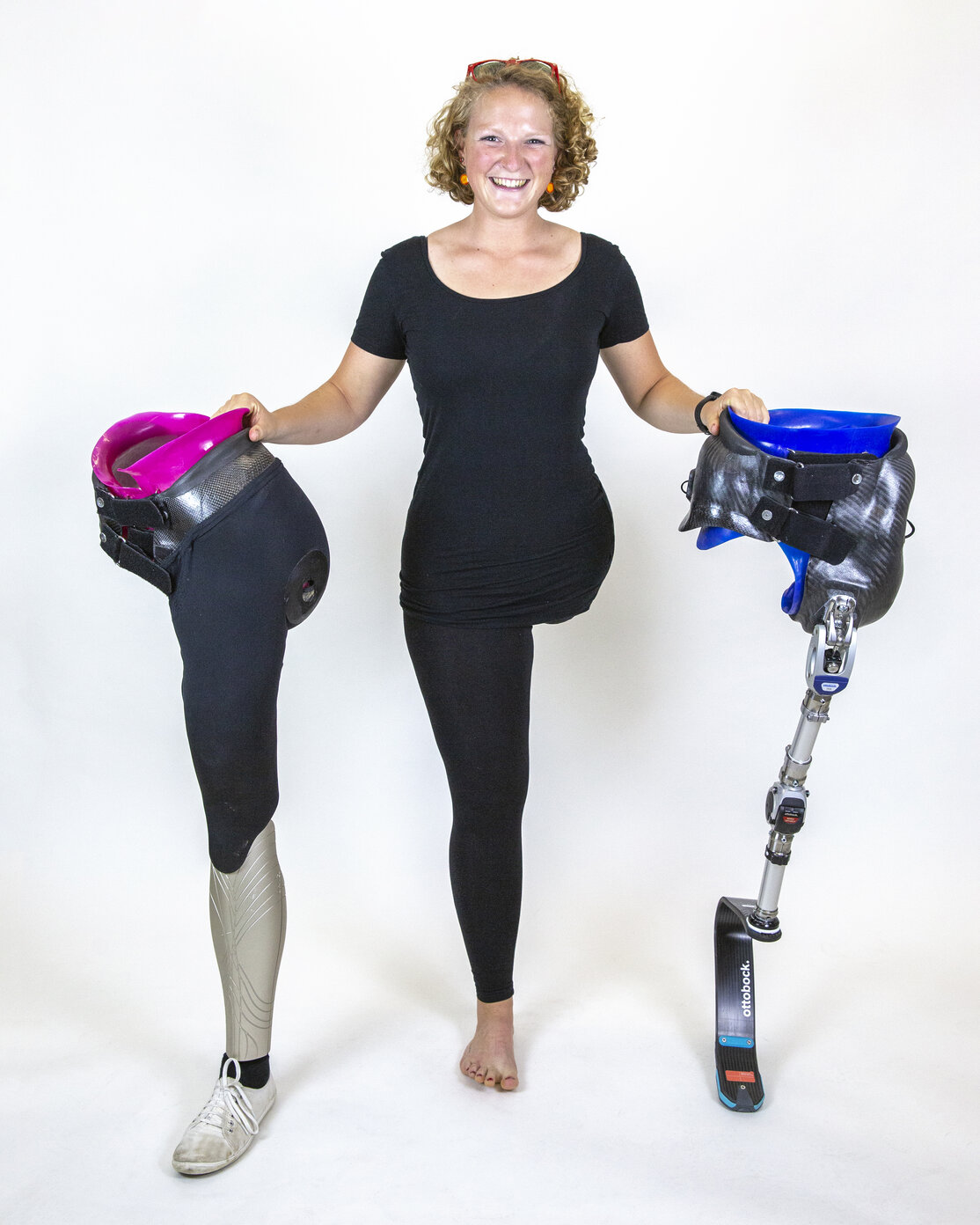 Hip disarticulation prosthesis after hip disarticulation