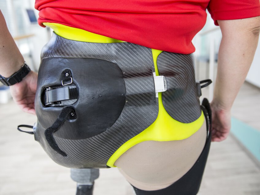 Hip Disarticulation Prosthesis