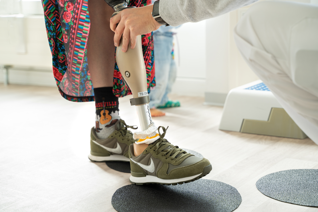 Oberschenkelprothese nach Amputation